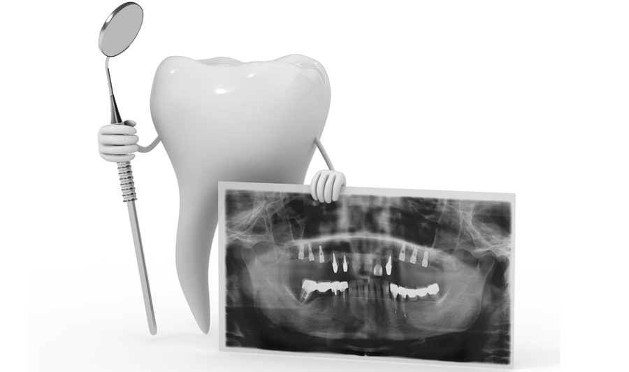 Qu’est-ce qu’un bilan long cône ? | Dentagora